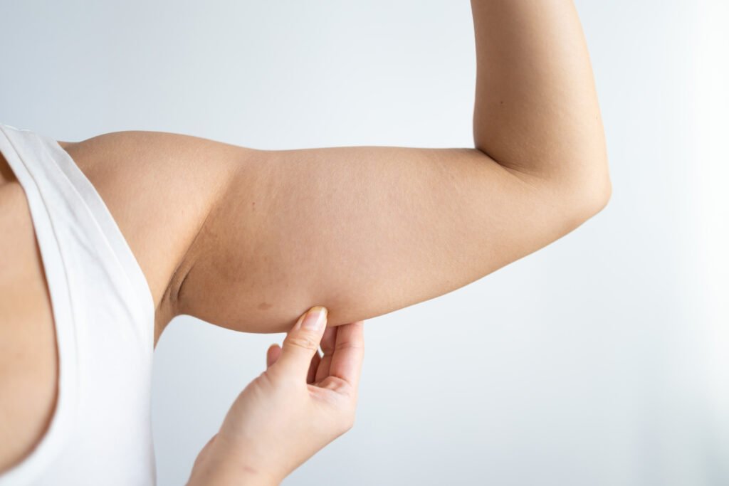 Arm Liposuction: A Breakthrough Solution for Arm Fat Reduction